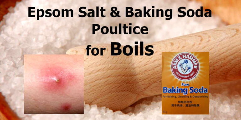 Epsom Salt for Boils - 4 The Best Remedies